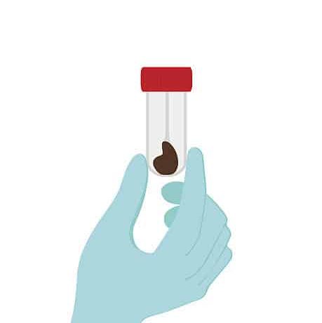 Complete Microbiome Mapping Stool Test | Auckland Gut Clinic
